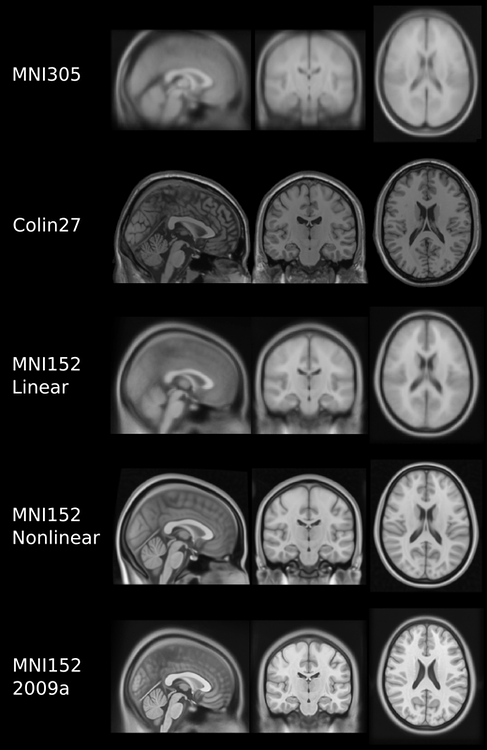 MNI空间和MNI模板 - 技术教程 - 神经影像技术社区论坛