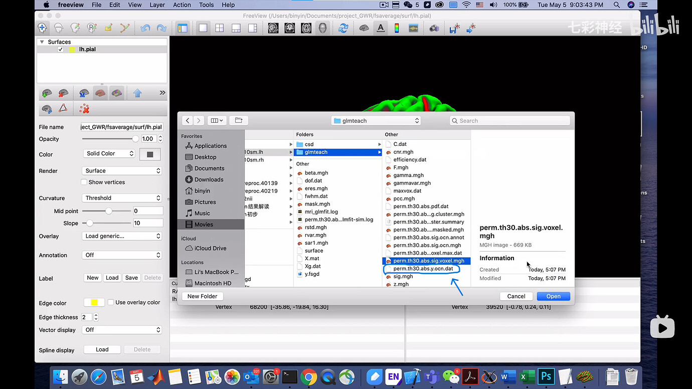 freesurfer跑完glm，多重校正之后，出现的差异脑区(annotation) - 问答讨论 - 神经影像技术社区论坛