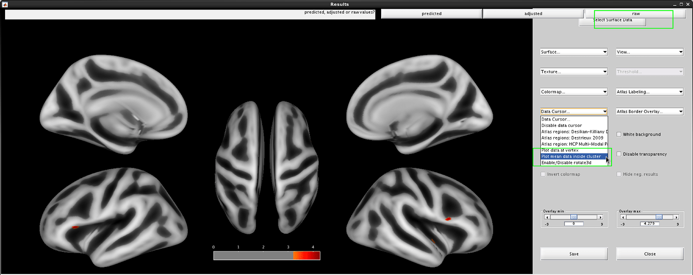 freesurfer跑完glm，多重校正之后，出现的差异脑区(annotation) - 问答讨论 - 神经影像技术社区论坛