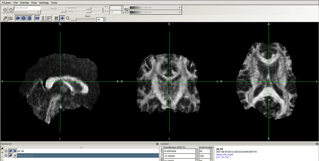 TBSS：mean_FA和all_FA缺失部分脑区 - 问答讨论 - 神经影像技术社区论坛